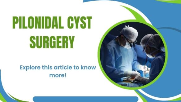 Pilonidal Cyst Surgery- Know About The Cyst Infection And Abscess ...