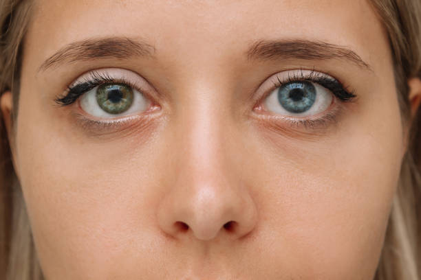17 Photos Of Unique People That Show That Genetics Is Unpredictable ...