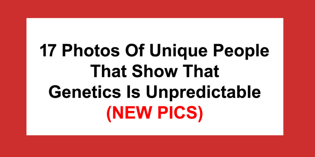 17 Photos Of Unique People That Show That Genetics Is Unpredictable ...